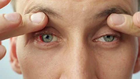 close-up of a man with red eyes, lifting... | Stock Video | Pond5