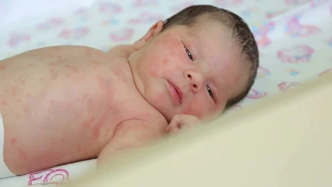 Close-up of a newborn baby with skin All... | Stock Video | Pond5