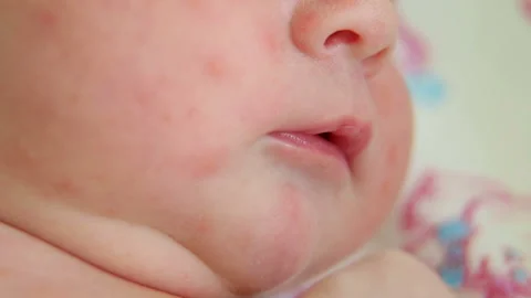 Close-up of a newborn baby with skin All... | Stock Video | Pond5