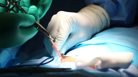 Open Surgery Viddeos Stock Videos – Royalty-Free HD & 4K Videos