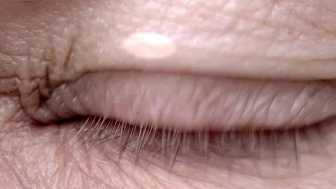 close up part face, human eye, spots on ... | Stock Video | Pond5