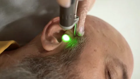 Close-up shot of Bold man head depilatio... | Stock Video | Pond5