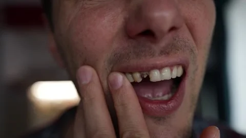 close-up shot of a toothless male mouth.... | Stock Video | Pond5