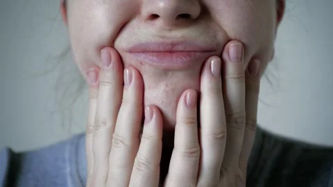 Unhealthy Skin Stock Video Footage | Royalty Free Unhealthy Skin Videos ...