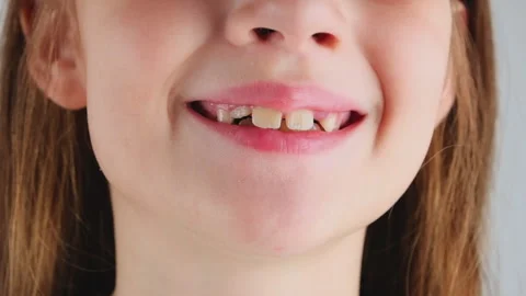 Close-up smile face of a child girl. A c... | Stock Video | Pond5