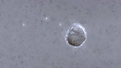 Close up at Sperm Cells Under Microscope... | Stock Video | Pond5