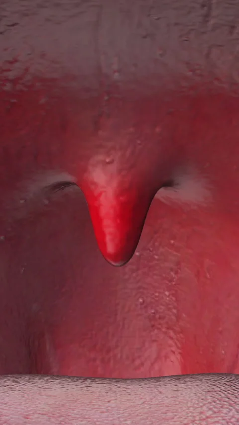 Close-up of a swollen uvula inside a hum... | Stock Video | Pond5