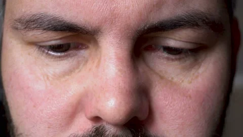 Close up view of a sick face 4K | Stock Video | Pond5