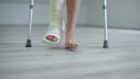 Close-up of woman's broken leg in plaste... | Stock Video | Pond5