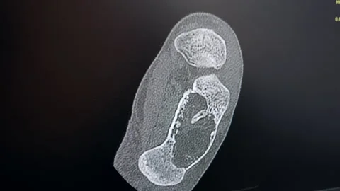 Closer look at the MRI scan of a body pa... | Stock Video | Pond5