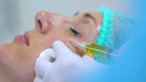 closeup picture of woman getting botox i... | Stock Video | Pond5