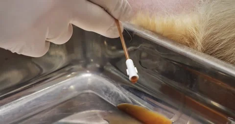 Cloudy urine drains into a tray from a u... | Stock Video | Pond5