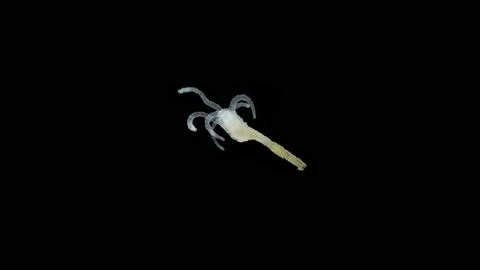 Cnidaria polyp under a microscope. White... | Stock Video | Pond5
