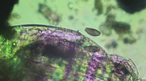 Ciliate Stock Video Footage | Royalty Free Ciliate Videos | Pond5