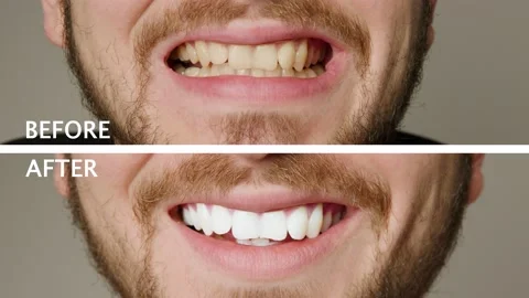 Collage Of Pictures Stock Footage ~ Royalty Free Stock Videos | Pond5