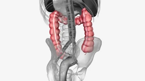 colon is also known as the large bowel o... | Stock Video | Pond5