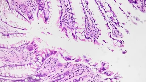 Colon Diagrama Stock Footage ~ Royalty Free Stock Videos | Pond5