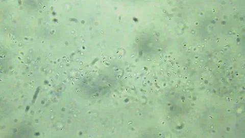 Colony of bacteria, microscope magnifica... | Stock Video | Pond5