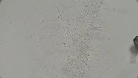 Spirochete Bacterium Stock Videos – Royalty-Free HD & 4K Videos