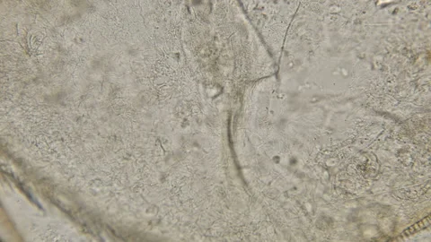 Spirochete Bacterium Stock Videos – Royalty-Free HD & 4K Videos