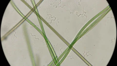 Spirochete Bacterium Stock Videos – Royalty-Free HD & 4K Videos