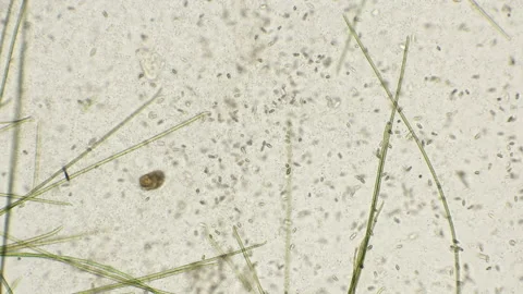 Spirochete Bacterium Stock Videos – Royalty-Free HD & 4K Videos