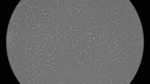 Spirochete Bacterium Stock Videos – Royalty-Free HD & 4K Videos