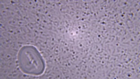 Bacteria Microscope Stock Footage ~ Royalty Free Stock Videos | Pond5