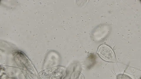 a colony of ciliates Stylonychia and vor... | Stock Video | Pond5