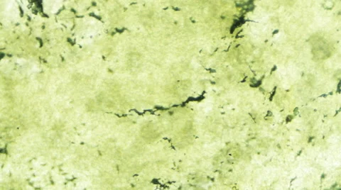 Bleeding Vein Stock Video Footage | Royalty Free Bleeding Vein Videos ...