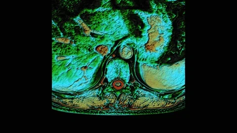 Color MRI of the thoracic region, detect... | Stock Video | Pond5