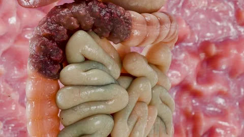 real intestines