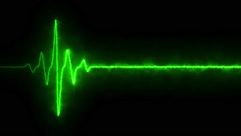 Pulse Green Screen Stock Video Footage | Royalty Free Pulse Green ...