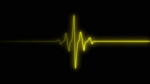 Colorful yellow heartbeat rate and pulse... | Stock Video | Pond5