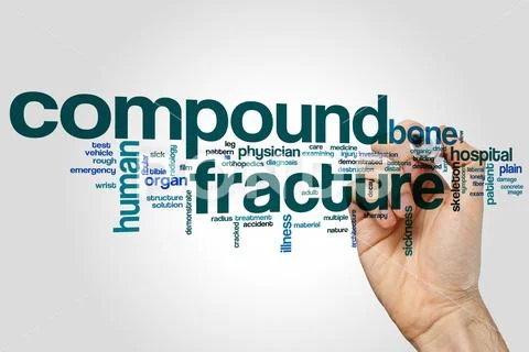 Compound fracture word cloud concept on grey background ~ Premium Photo ...