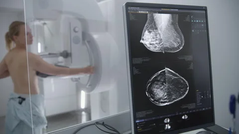 Mammogram Machine Stock Video Footage | Royalty Free Mammogram Machine ...
