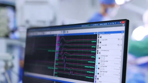 Computer monitor displaying brain waves ... | Stock Video | Pond5