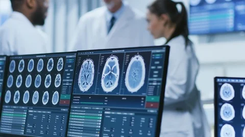 Computer Screen Showing MRI, CT Image Sc... | Stock Video | Pond5