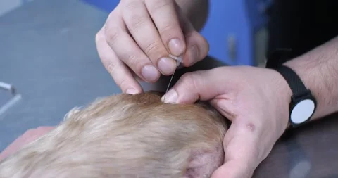 Epidural Stock Footage ~ Royalty Free Stock Videos | Pond5