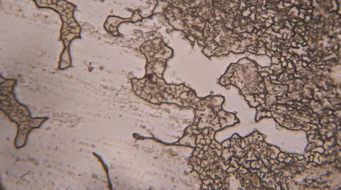 Congealed blood cells under the microsco... | Stock Video | Pond5