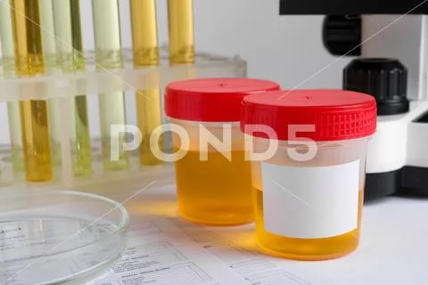 Containers with urine samples on table in laboratory, space for text ...