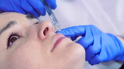 Contour Lip injection of hyaluronic acid | Stock Video | Pond5