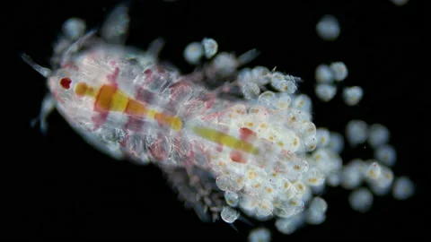 Copepoda Harpacticoida under the microsc... | Stock Video | Pond5