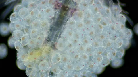 Copepoda Harpacticoida under the microsc... | Stock Video | Pond5