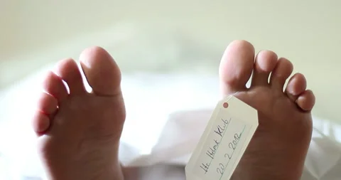 Corpse in the pathology, showing the fee... | Stock Video | Pond5