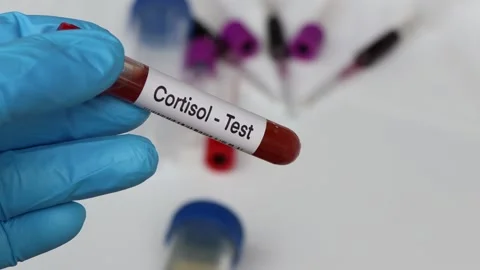 Cortisol test to look for abnormalities ... | Stock Video | Pond5