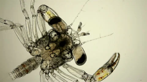 The crab larva under the microscope, at ... | Stock Video | Pond5