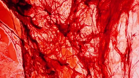 Crime Scene.Hair in blood texture.True C... | Stock Video | Pond5