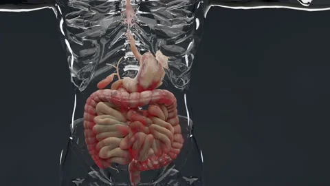 crohns disease, inflamed large intestine... | Stock Video | Pond5