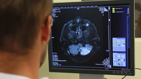 Doctor Ct Scan Stock Videos – Royalty-Free HD & 4K Videos